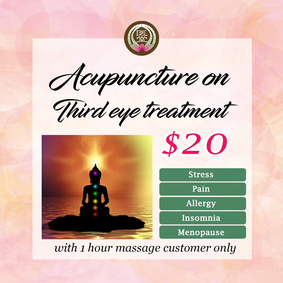 Japanese Acupuncture - iDo Holistic Center